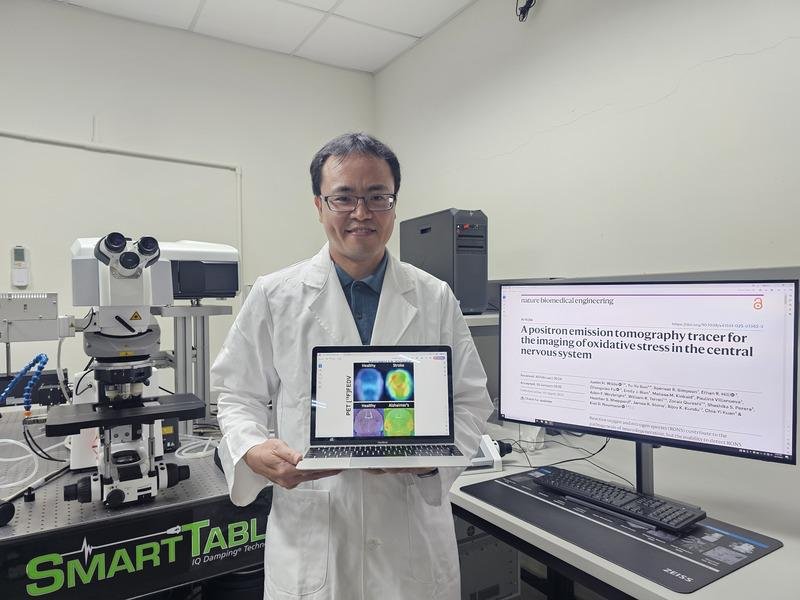 New Non-Invasive Imaging for Brain Disorders Developed - theasiareview.com